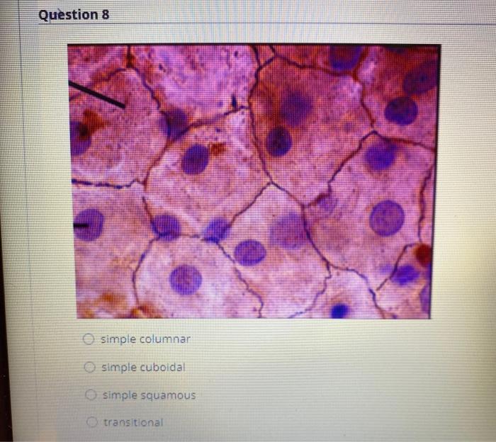 Solved Question 7 9 simple columnar simple cuboidal e simple | Chegg.com