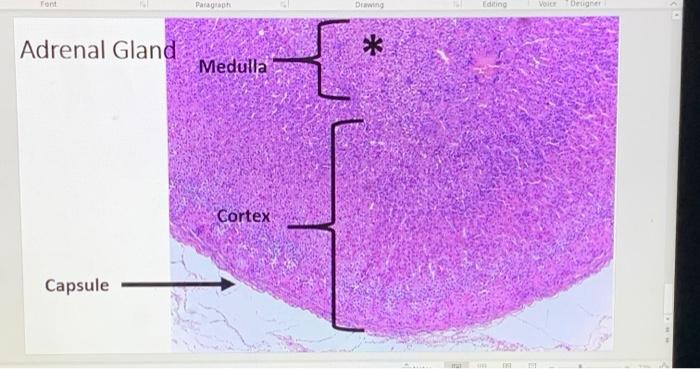 Solved Pancreas Exocrine Tissue Pancreatic Islet Note | Chegg.com