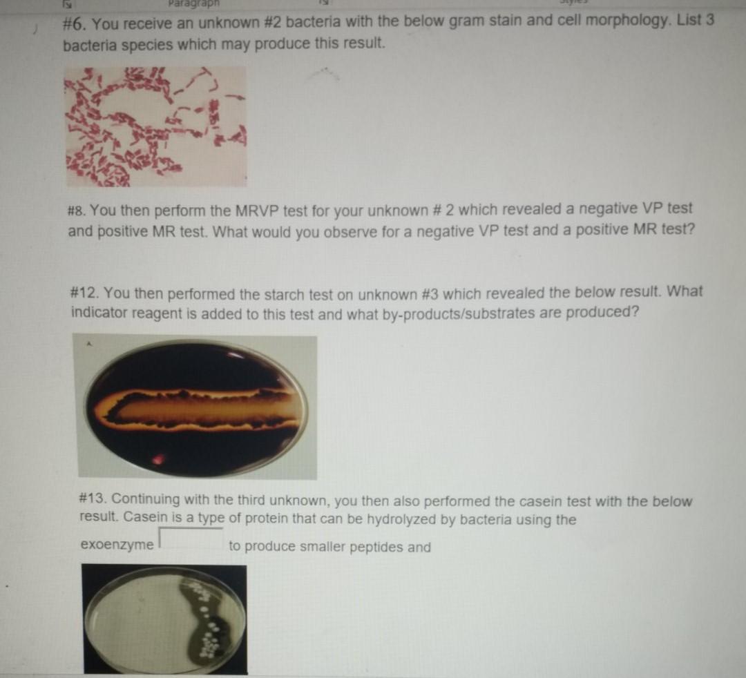 Solved Paragraph #6. You receive an unknown #2 bacteria with | Chegg.com