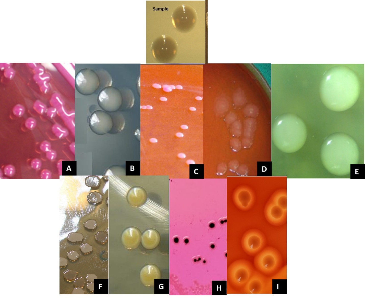 Solved 1. ) ﻿The following picture shows colonies of the | Chegg.com