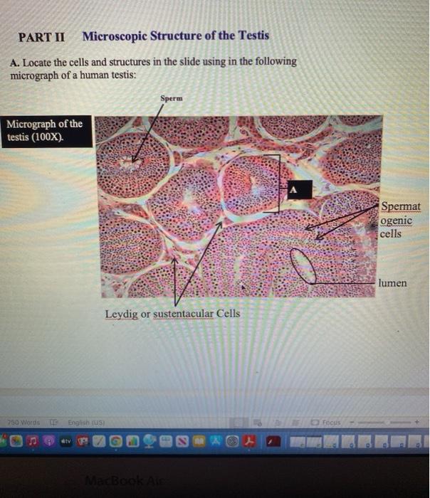Solved PART II Microscopic Structure of the Testis A. Locate | Chegg.com