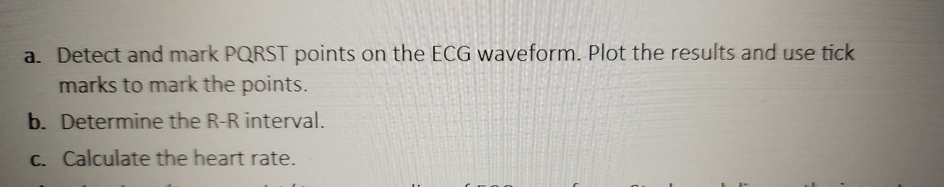 Solved a. Detect and mark PQRST points on the ECG waveform. | Chegg.com