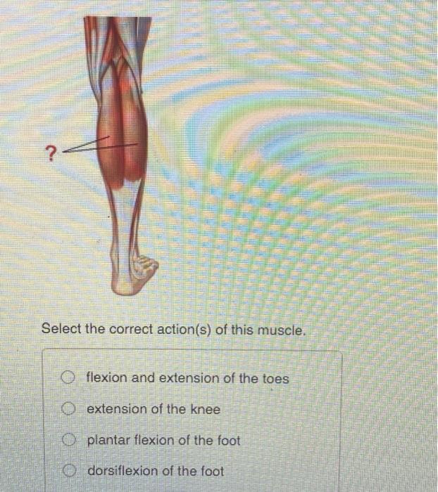 Solved LT-VA16. Life-size Muscle Torso, 27 part, What is an | Chegg.com