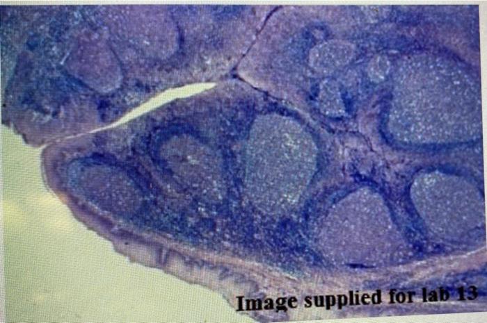 Solved Label the Tonsil Slide. Identify CryptLymphatic | Chegg.com