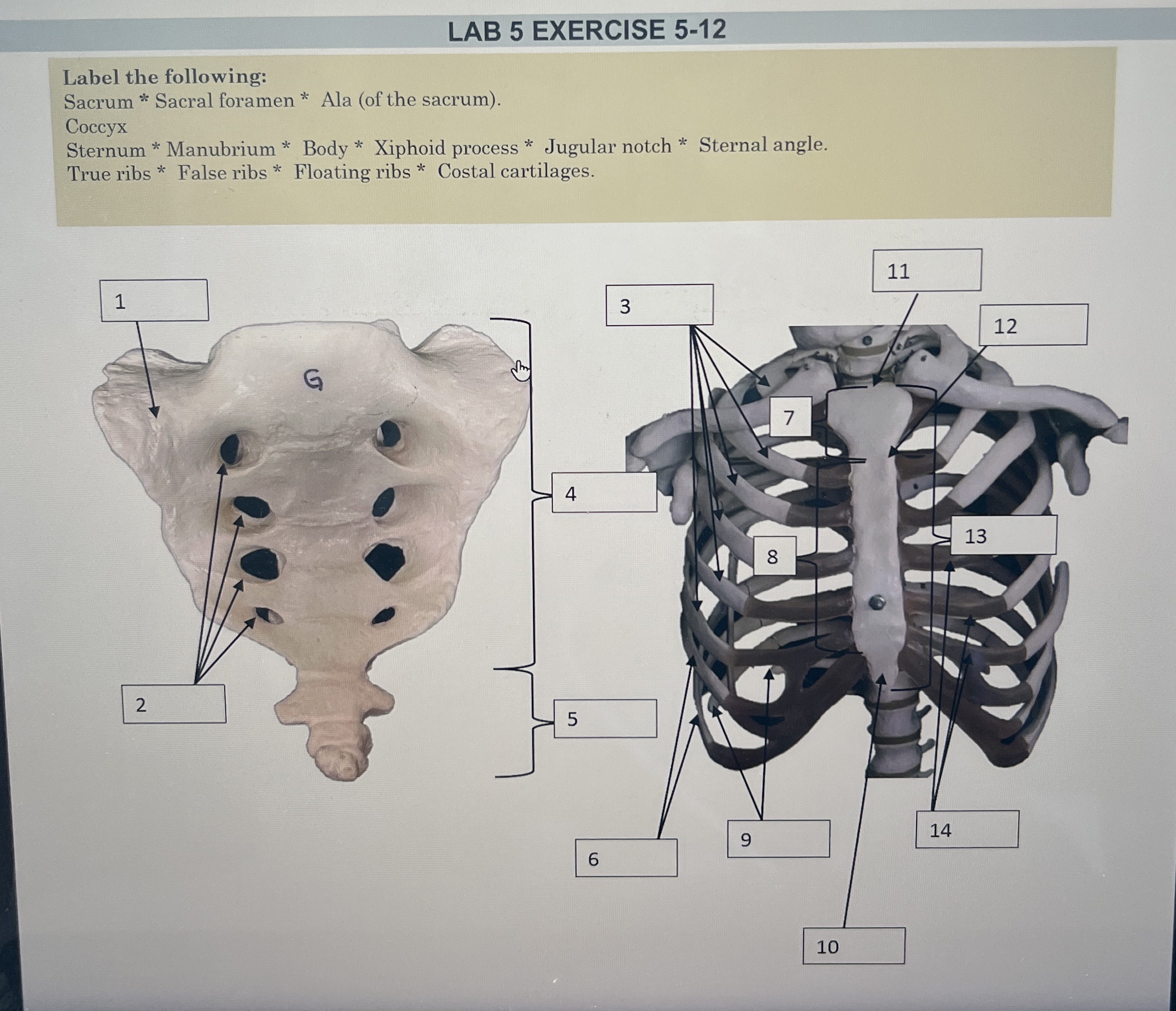Solved LAB 5 ﻿EXERCISE 5-12Label the following:Sacrum * | Chegg.com