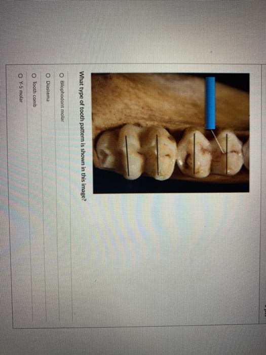 Solved What type of tooth pattern is shown in this image? O | Chegg.com