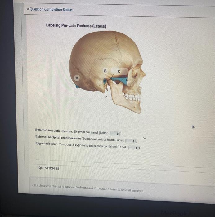 Solved QUESTION 7 Labeling Pre-Lab: Features of Cranial | Chegg.com