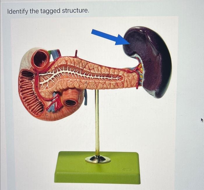 Solved Identify the tagged structure. a. Duodenum. b. Right | Chegg.com