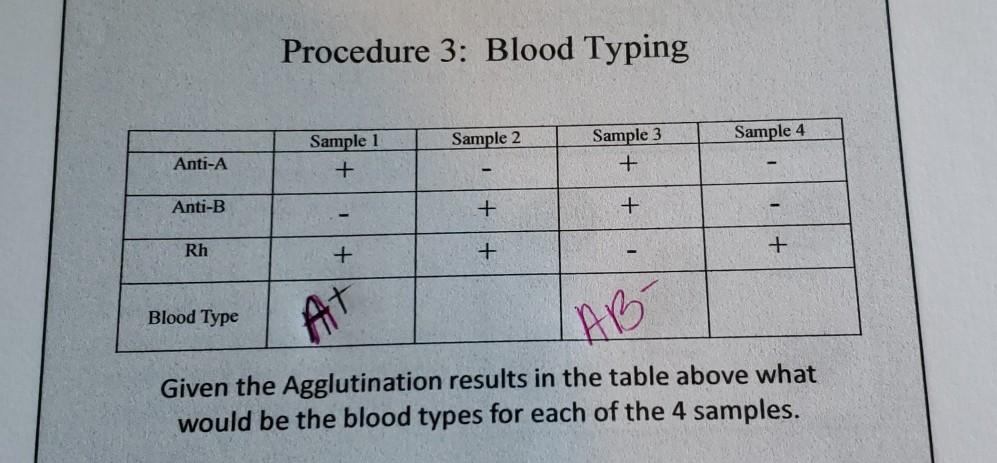 Solved Procedure 3: Blood Typing Sample 2 Sample 4 Sample 1 | Chegg.com