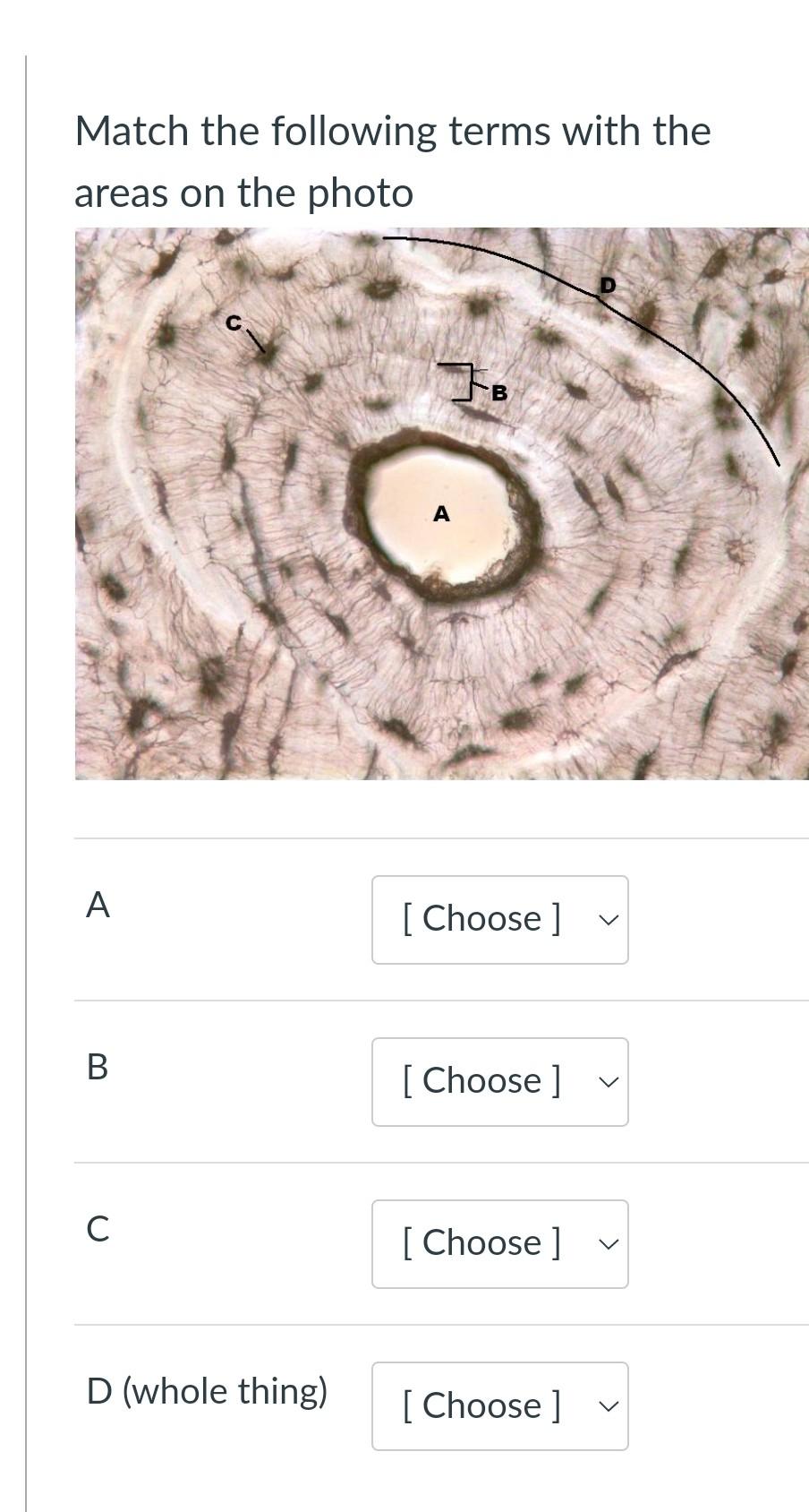 Solved Match the following bone structures to the bones. | Chegg.com
