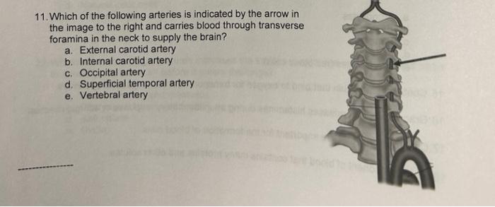 Solved 11. Which of the following arteries is indicated by | Chegg.com