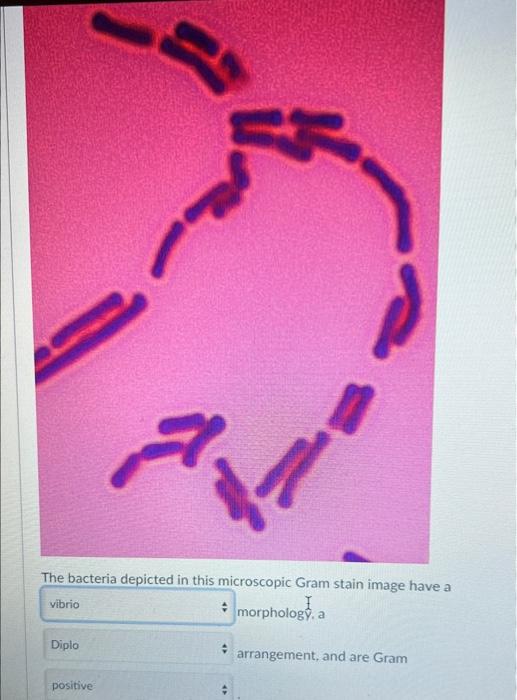 Vibrio Gram Stain