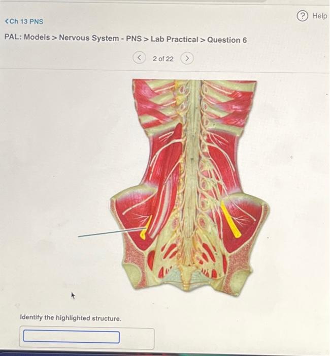 Solved PAL: Models > Nervous System - PNS > Lab Practical > | Chegg.com