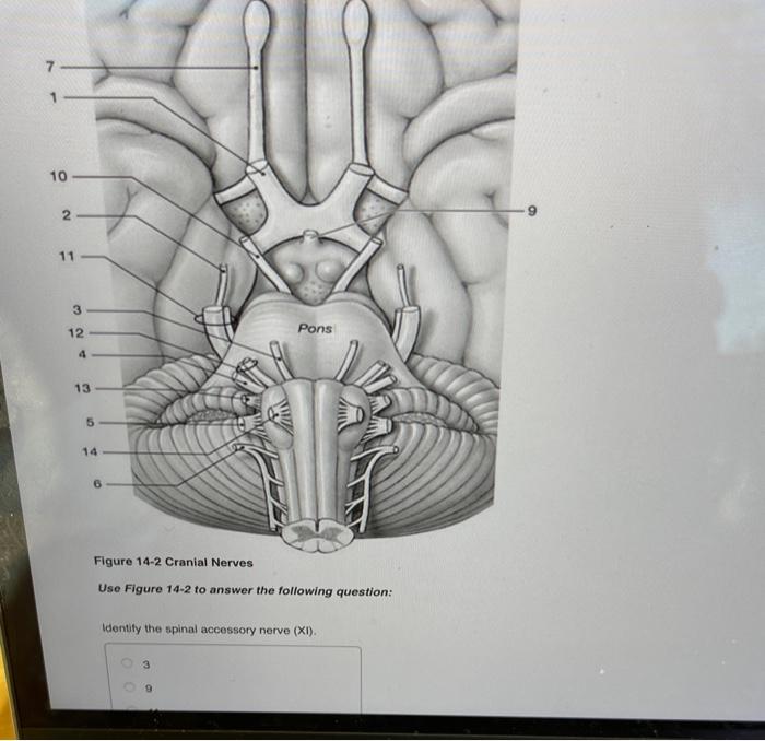 Solved Use Figure 14-2 to answer the following question: | Chegg.com