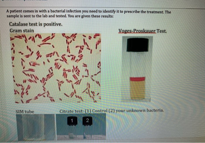 Solved SIM tube Citrate test: (1) Control (2) your unknown | Chegg.com