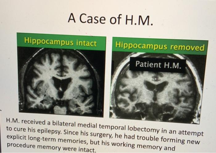 Solved son that H.M.'s working memory was intact is because | Chegg.com