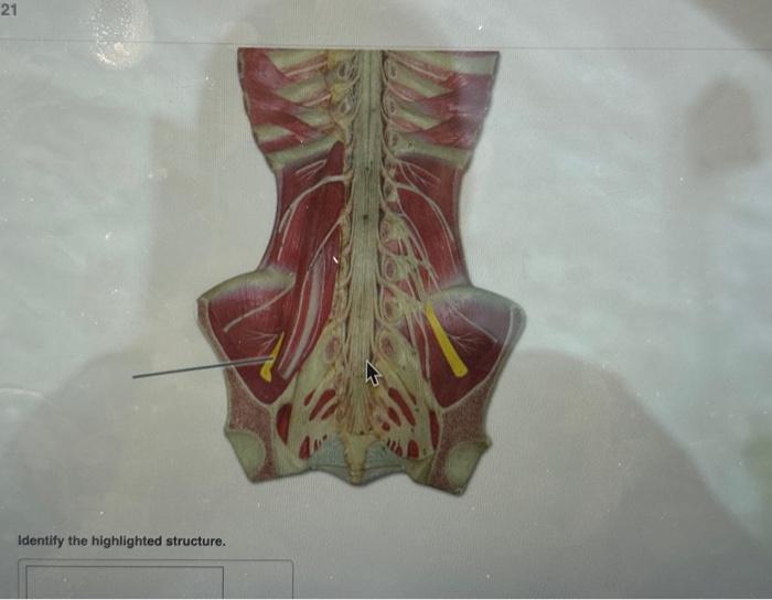 Identify the highlighted structure. | Chegg.com