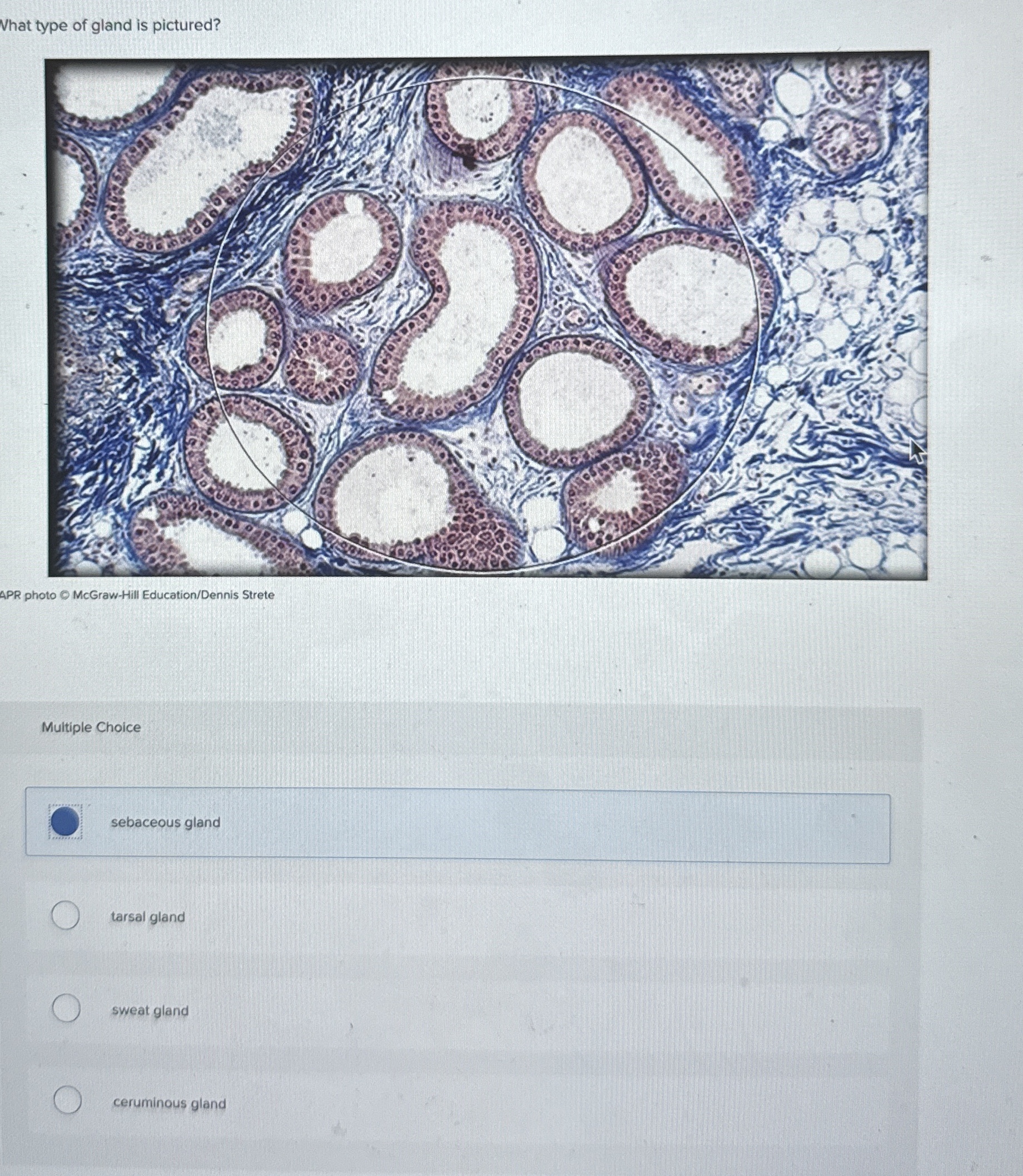 Solved What type of gland is pictured?APR photo McGraw-Hill | Chegg.com