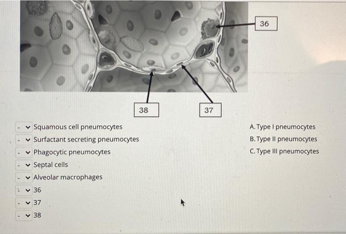 Solved 36 38 37 A. Type I pneumocytes B. Type II pneumocytes | Chegg.com