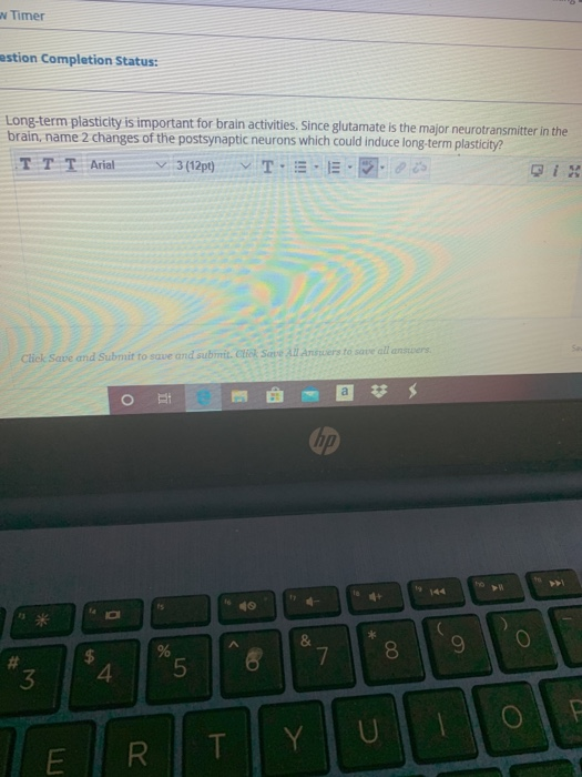 Solved Timer estion Completion Status: Long-term plasticity | Chegg.com