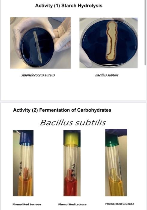 Solved Activity (1) Starch Hydrolysis Staphylococcus aureus | Chegg.com