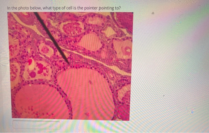 Solved In the photo below, what type of cell is the pointer | Chegg.com