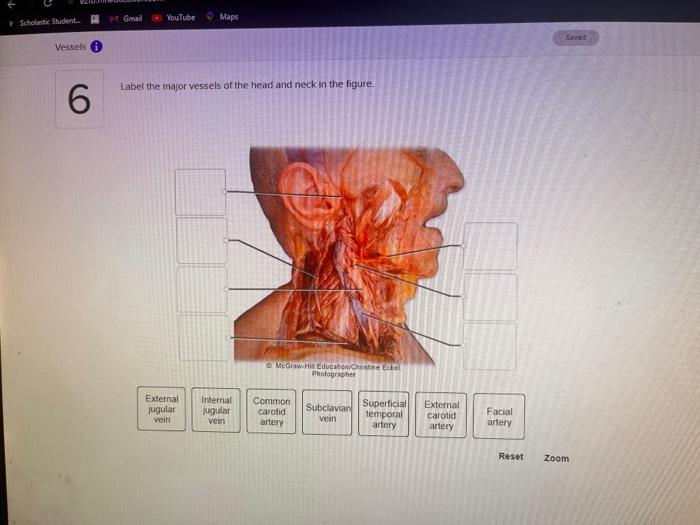 Solved Label the major vessels of the head and neck in the | Chegg.com