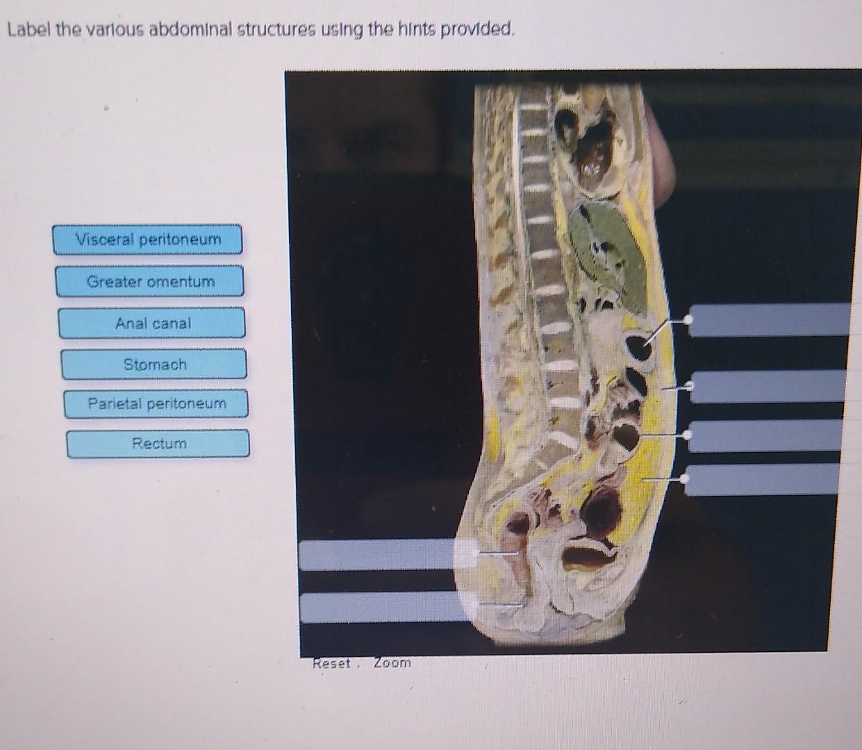 Solved Label the varlous abdominal structures using the | Chegg.com