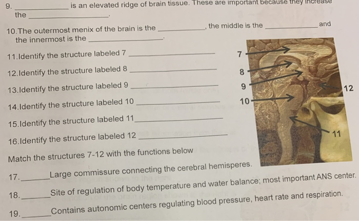 Solved 9. is an elevated ridge of brain tissue. These are | Chegg.com