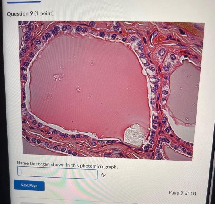 Solved Question 9 (1 point) Name the organ shown in this | Chegg.com