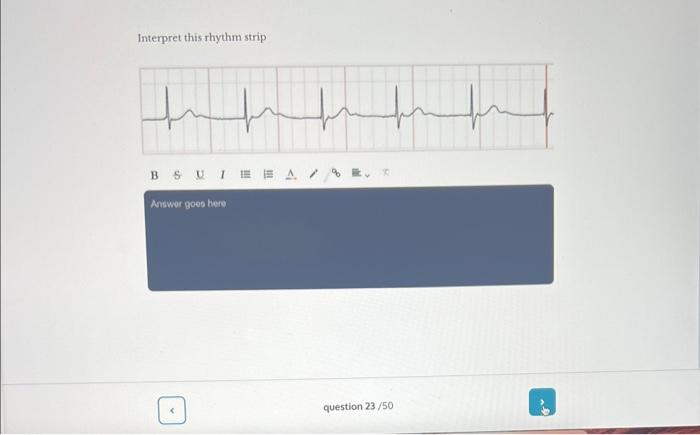 Solved Interpret this rhythm strip Interpret this rhythm | Chegg.com