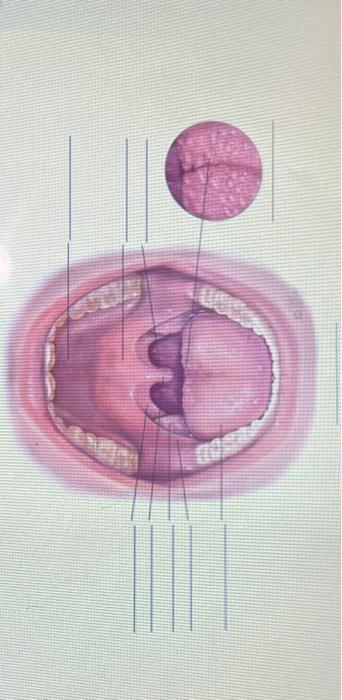 Solved Fill in the labels indicated on the following | Chegg.com