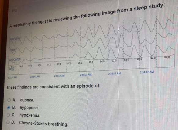 Solved These findings are consistent with an episode of A. | Chegg.com