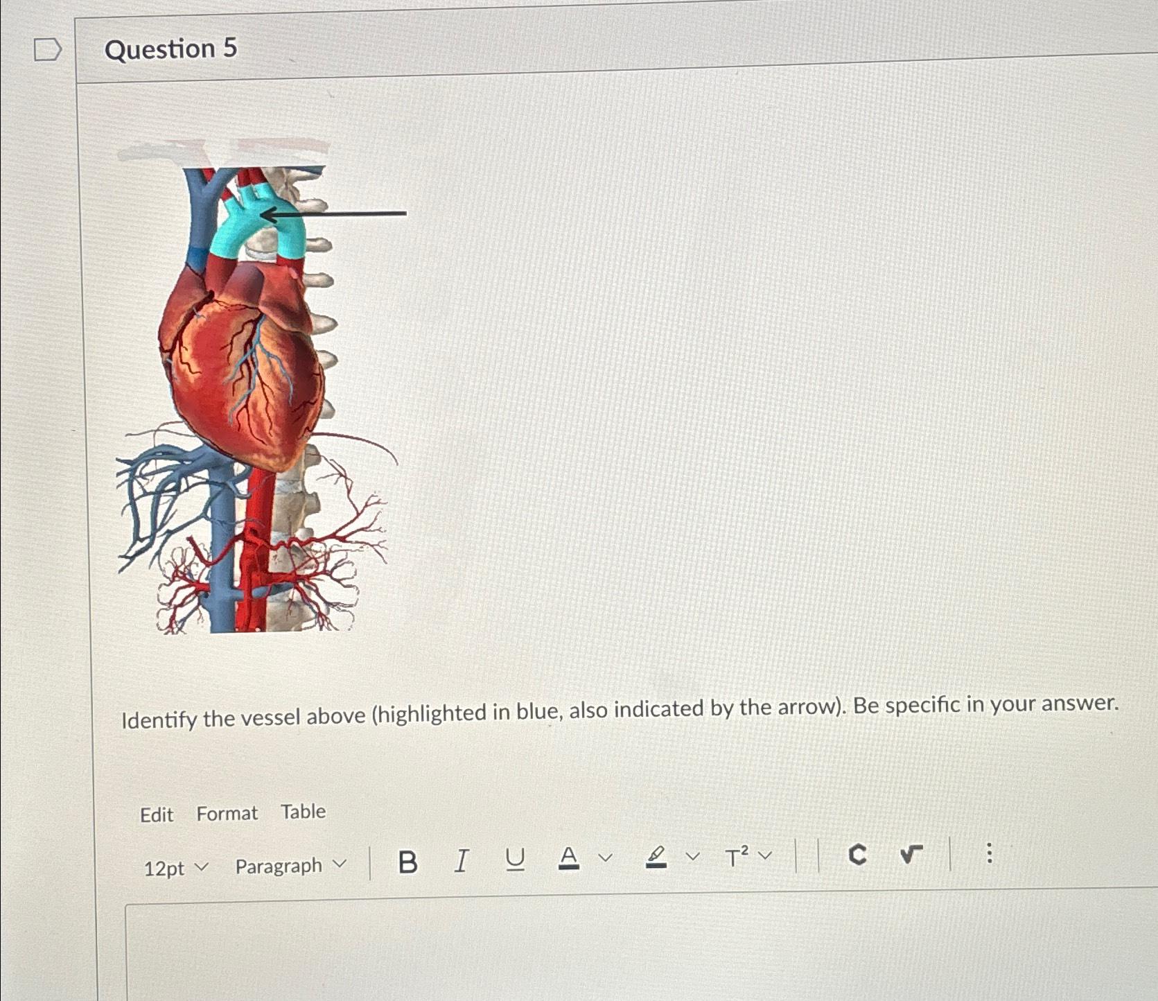 Solved Question 5Identify the vessel above (highlighted in | Chegg.com