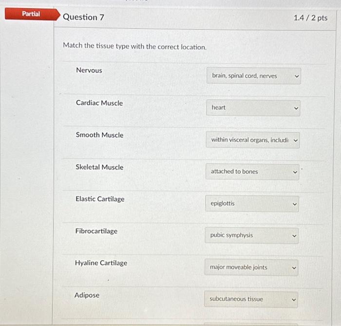 Solved Not sure which ones I got wrong (the answers choices | Chegg.com