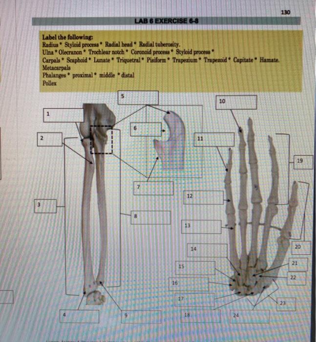 Solved Label the following Scapula Spine Coracoid proces | Chegg.com