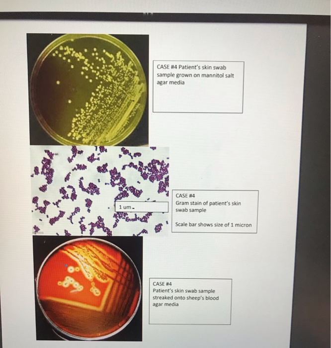 Solved CASE #4 Patient's skin swab sample grown on mannitol | Chegg.com
