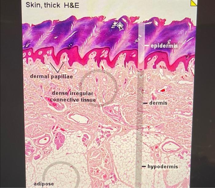 Solved question 1 - based off the think and thick skin | Chegg.com