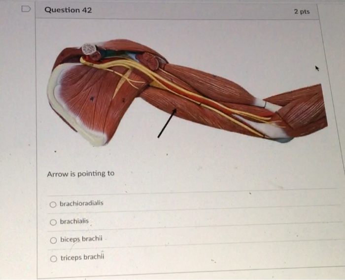 Solved The origin for the muscle arrow is pointing to is | Chegg.com