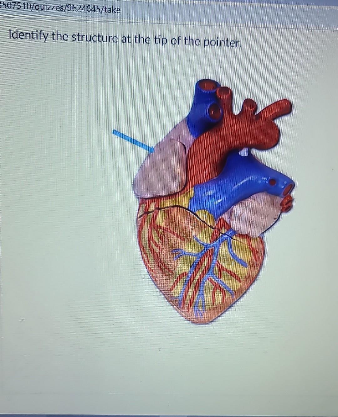 Solved Identify the structure at the tip of the pointer. | Chegg.com