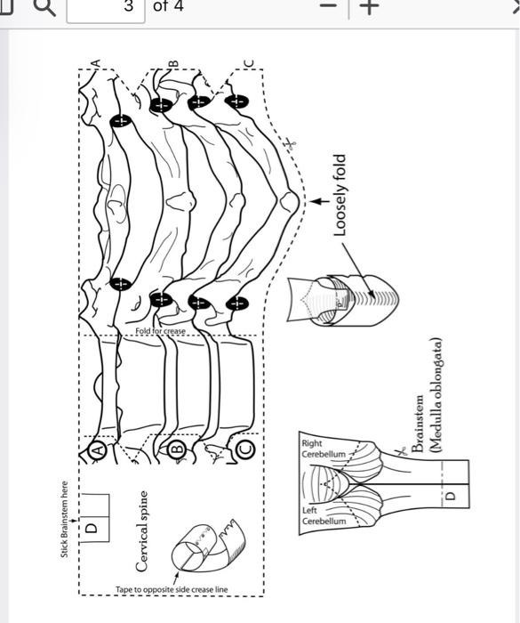Brain Cap PatternTo Make the "Cap" (21pts) | Chegg.com