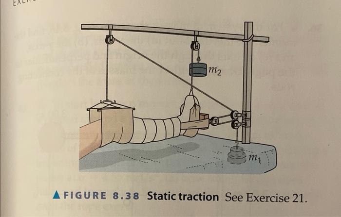 Solved 21. ∙ A variation of Russell traction ( Fig. 8.38) | Chegg.com
