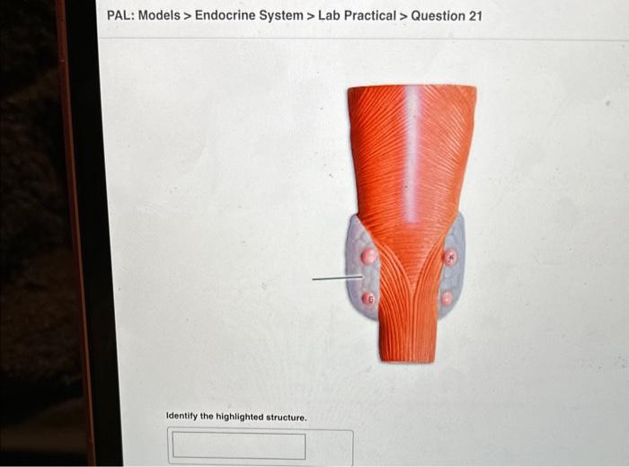 Solved PAL: Models > Endocrine System > Lab Practical > | Chegg.com