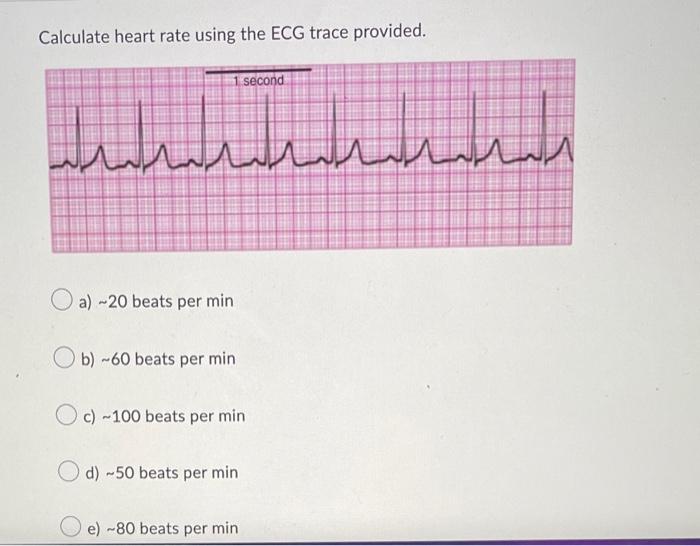 Solved Calculate heart rate using the ECG trace provided. a) | Chegg.com