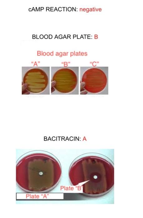 Solved CAMP REACTION: negative BLOOD AGAR PLATE: B Blood | Chegg.com