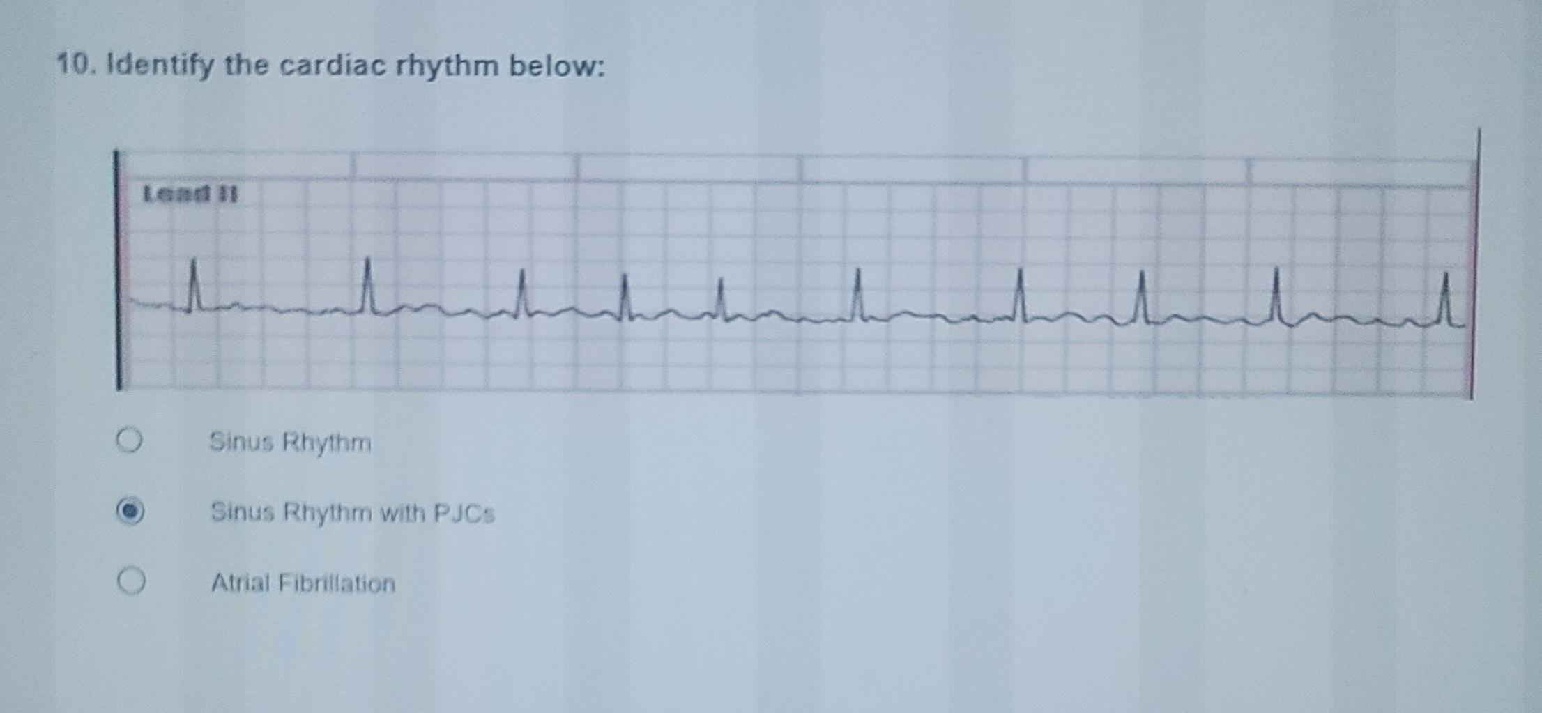Solved Identify the cardiac rhythm below:Sinus RhythmSinus | Chegg.com Solved Identify the cardiac rhythm below:Sinus RhythmSinus | Chegg.com
