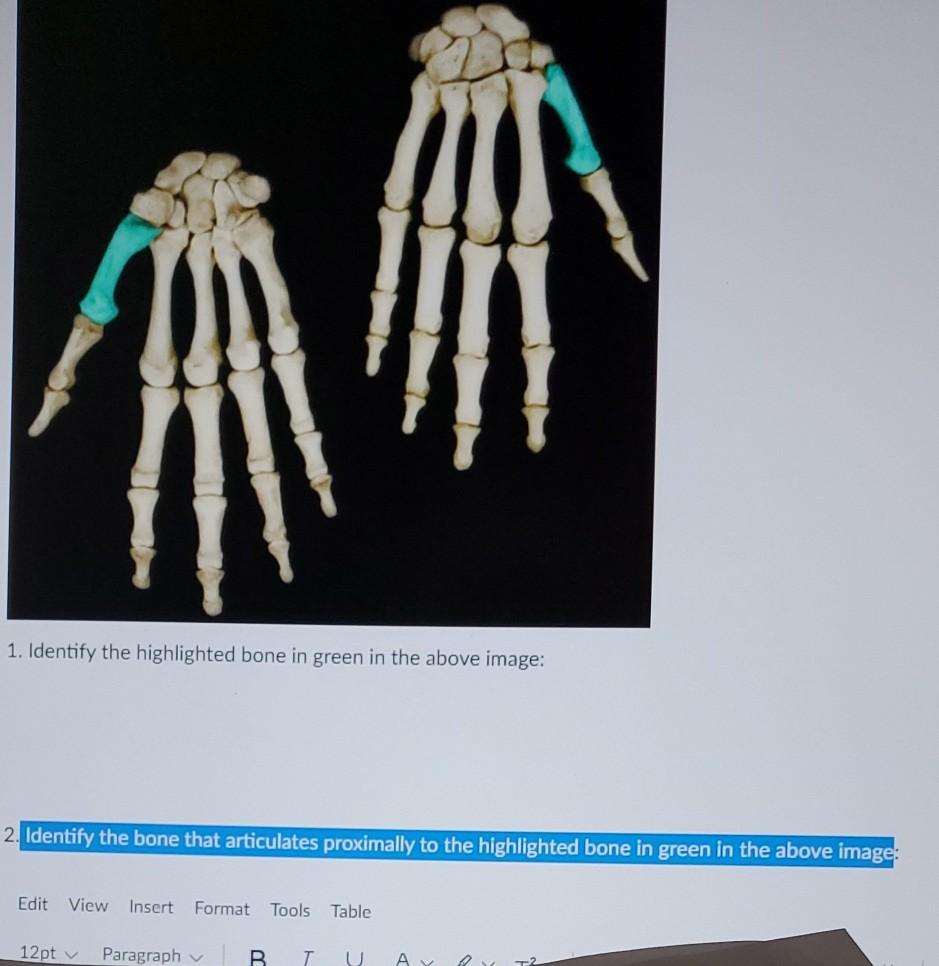 Solved 1. Identify the highlighted bone in green in the | Chegg.com