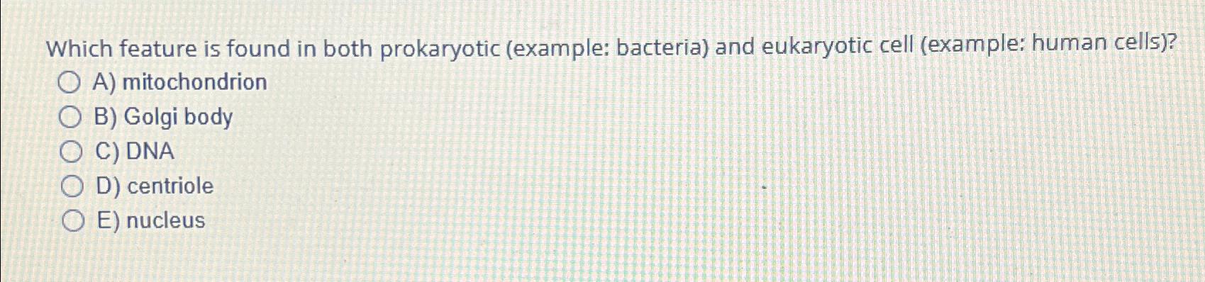 Solved Which feature is found in both prokaryotic (example: | Chegg.com