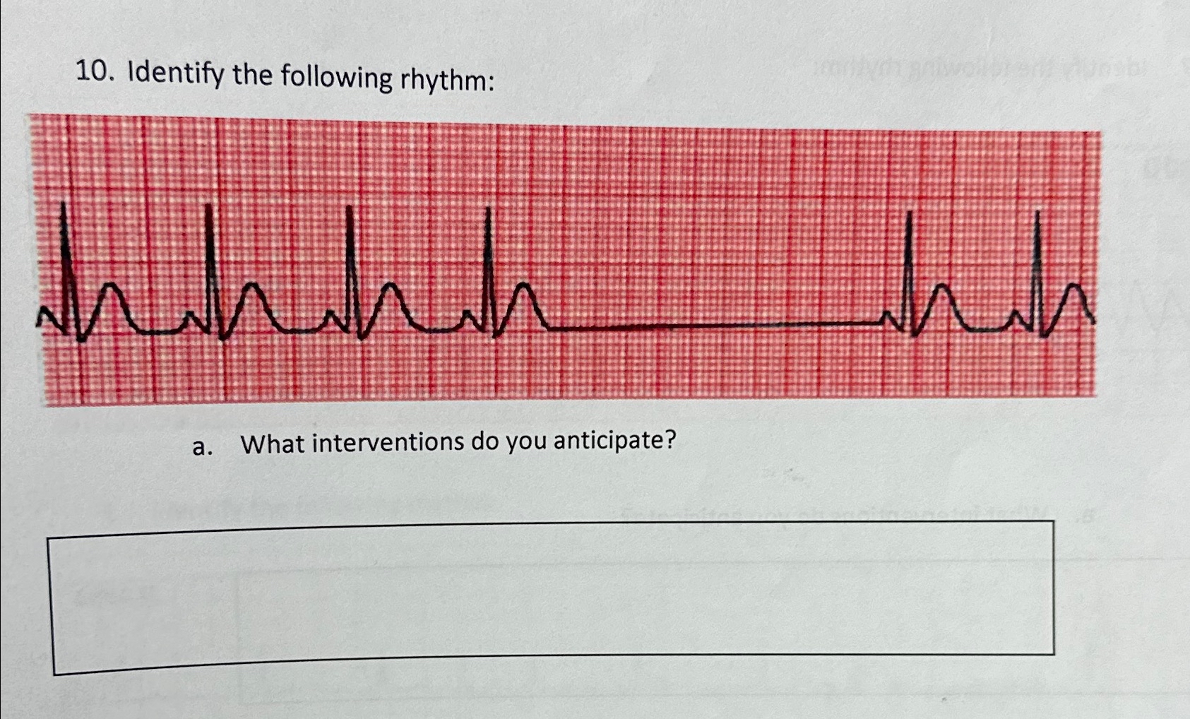Solved Identify the following rhythm:a. ﻿What interventions | Chegg.com