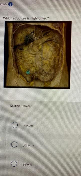 Solved stive Which structure is highlighted? Multiple Choice | Chegg.com
